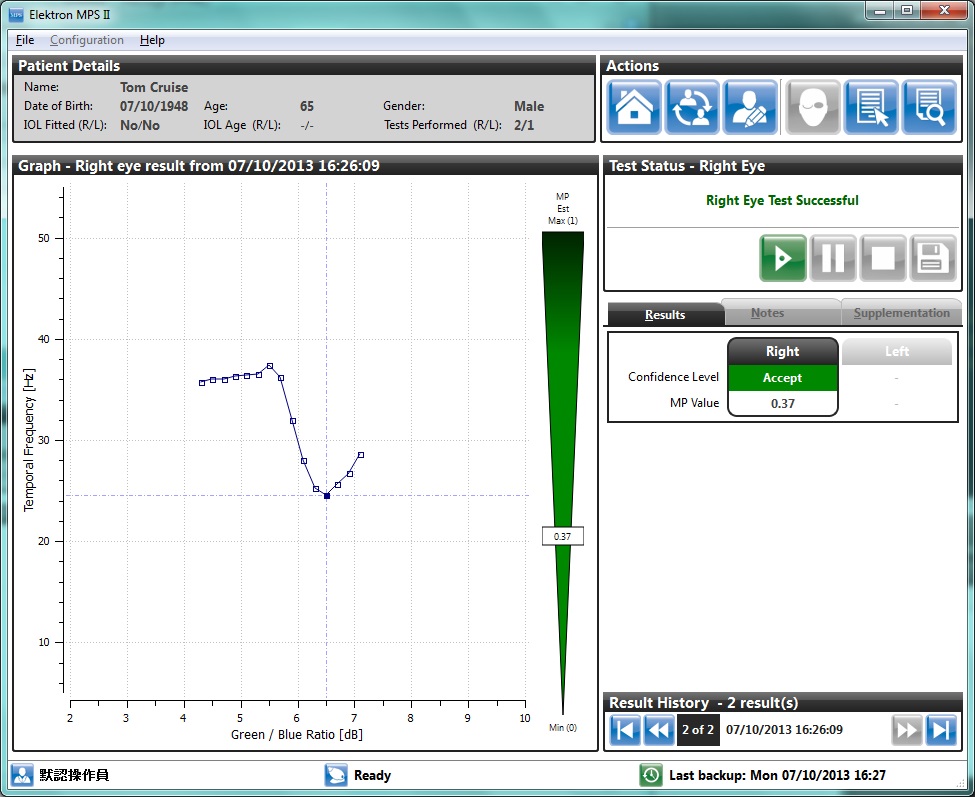 MPS II Technical Data - Macular degeneration, macular degeneration test ...
