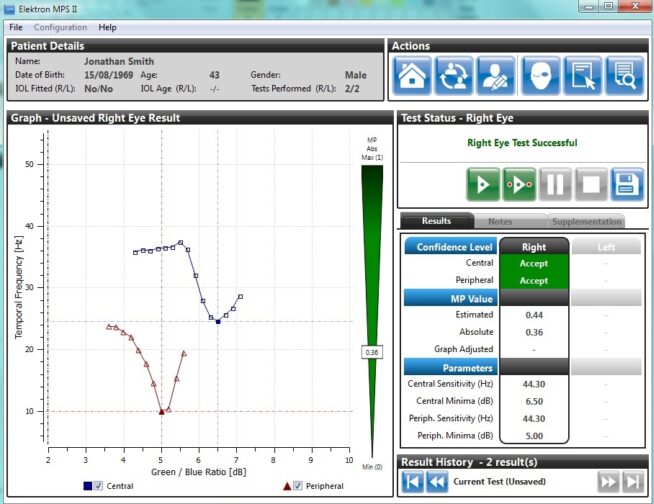MPS II Technical Data - Macular degeneration, macular degeneration test